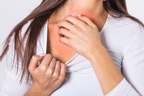 Lymská borelióza: Flek a další příznaky, léčba i následky ...